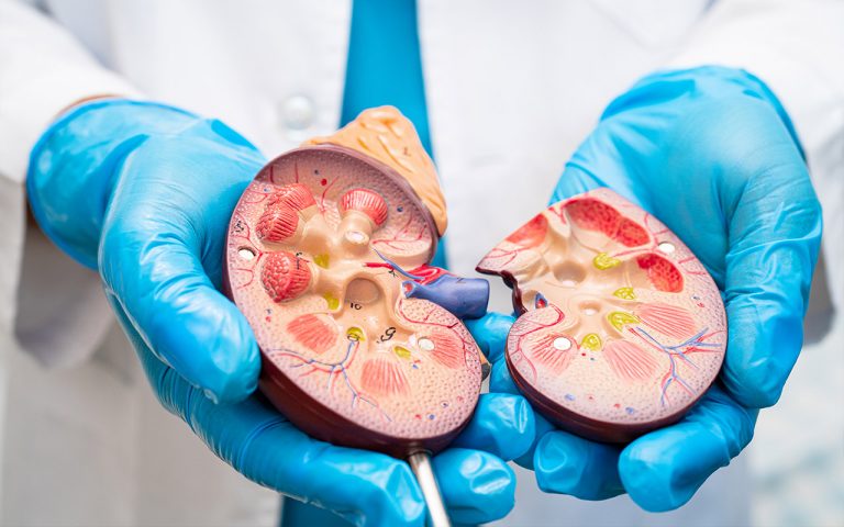 Finerenona y empagliflozina en enfermedad renal crónica y diabetes tipo ...